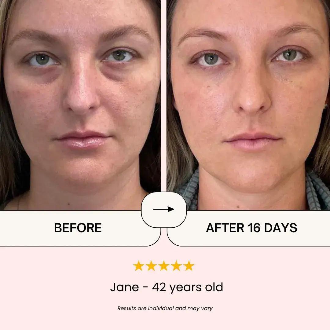 LuminEye reusable LED patches for dark circles & eye bags – cellenceskin