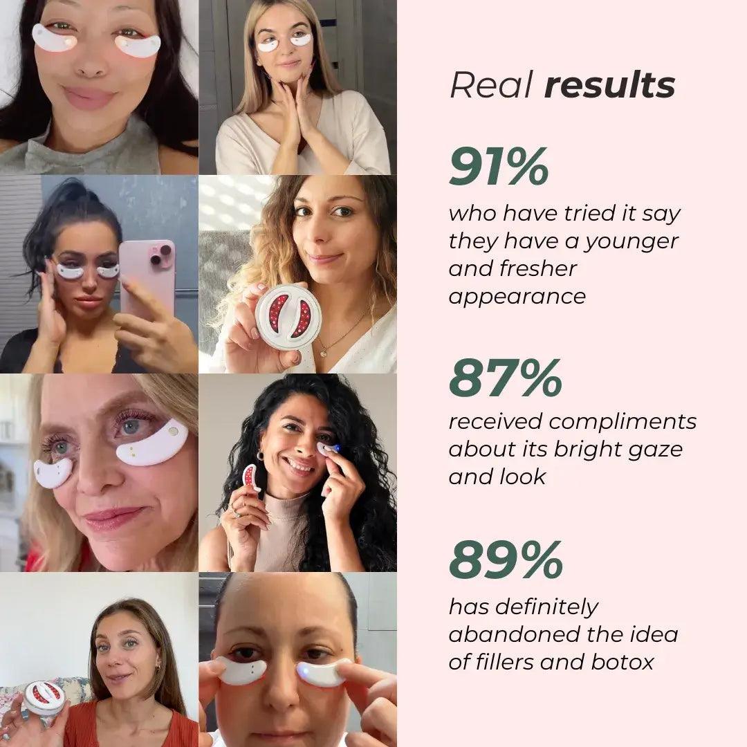 LuminEye reusable LED patches for dark circles & eye bags – cellenceskin